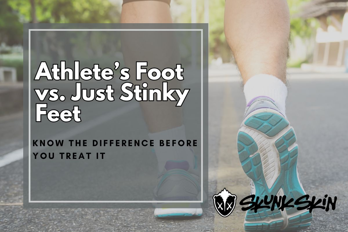 Athlete’s Foot vs. Just Stinky Feet | Skunk Skin